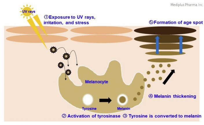 New ways to reduce facial age spots. Japanese Pharmaceutical R&D ...